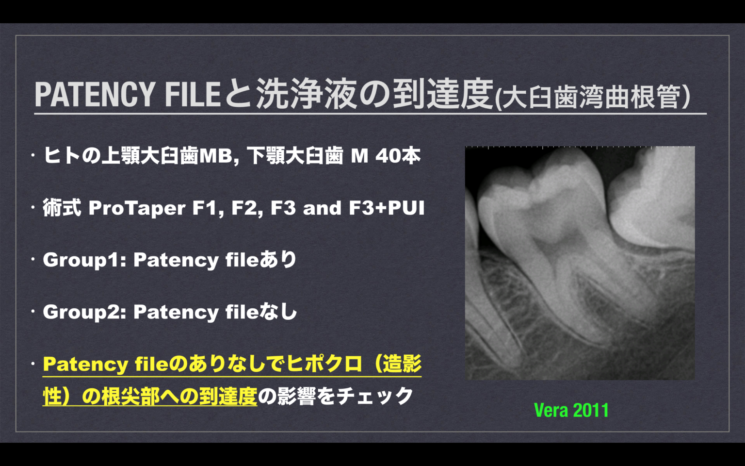 Apical Patency - まつうら歯科医院 歯内療法専門室