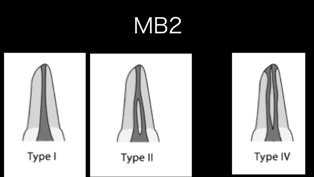 Basic Course 2023 第4回〜マイクロエンド実習（前歯、小臼歯、大臼歯） - まつうら歯科医院 歯内療法専門室
